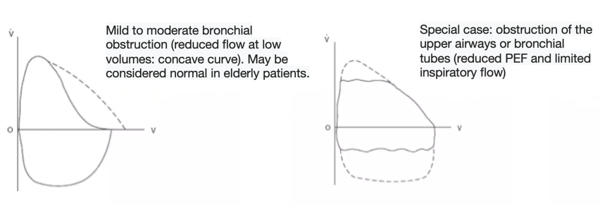 Respiratory function testing (RFT) - elements of interpretation ...